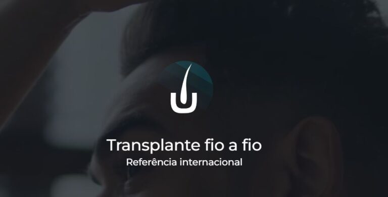 Diferenças Entre Técnicas de Transplante Capilar: FUE, FUT e Fio a Fio ...